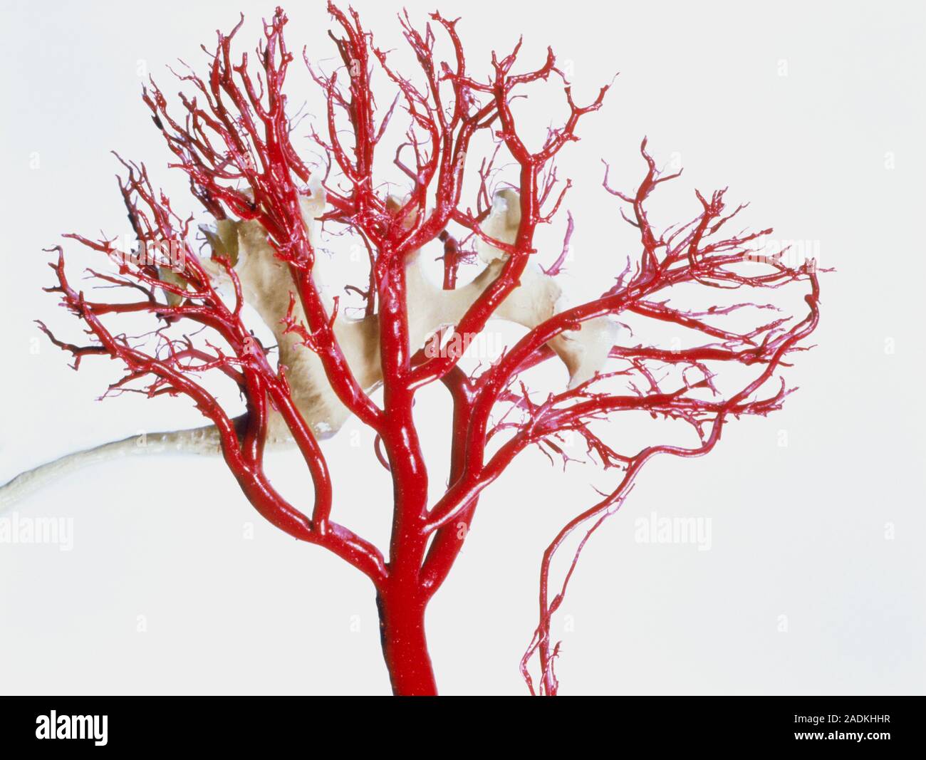 Resin cast of the arterial blood supply (red) to a kidney. The white ...