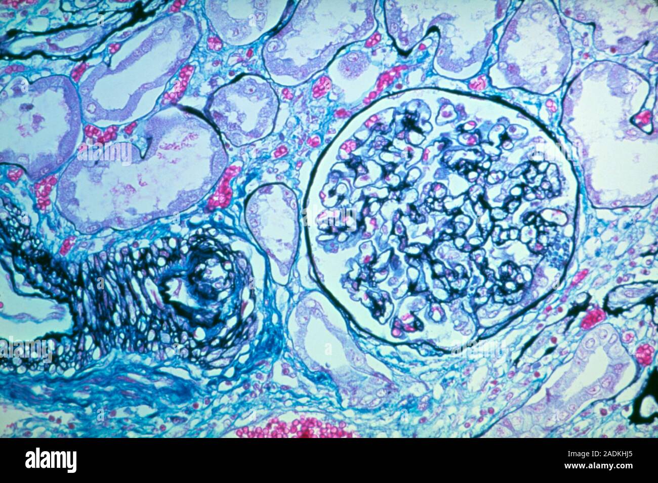 Light micrograph of a section through a human kidney, showing a ...