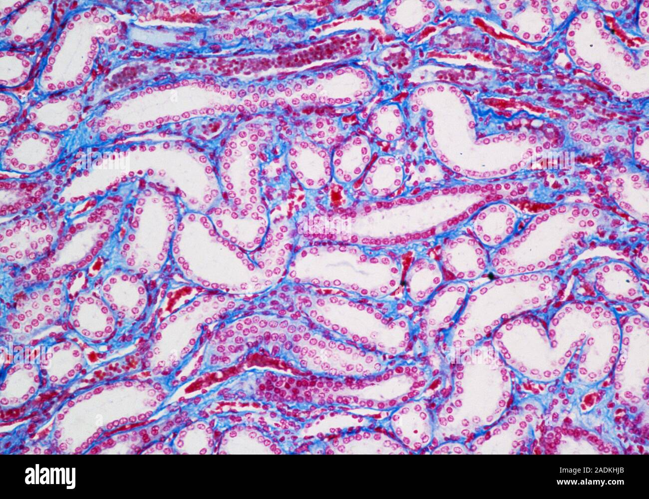 Light micrograph of normal human kidney, showing convoluted tubules in ...