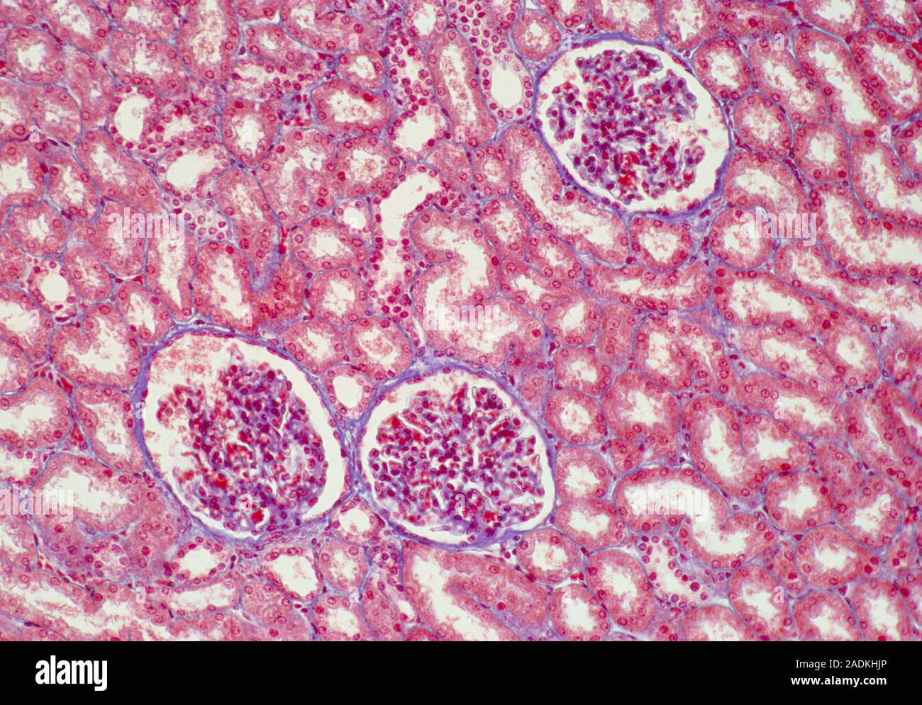 Light micrograph of the cortex of a normal human kidney, showing three ...