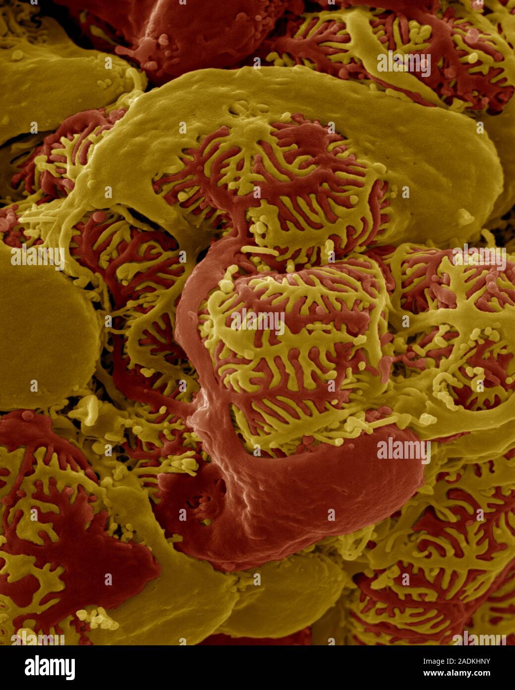 Kidney glomerulus. Coloured scanning electron micrograph (SEM) of ...