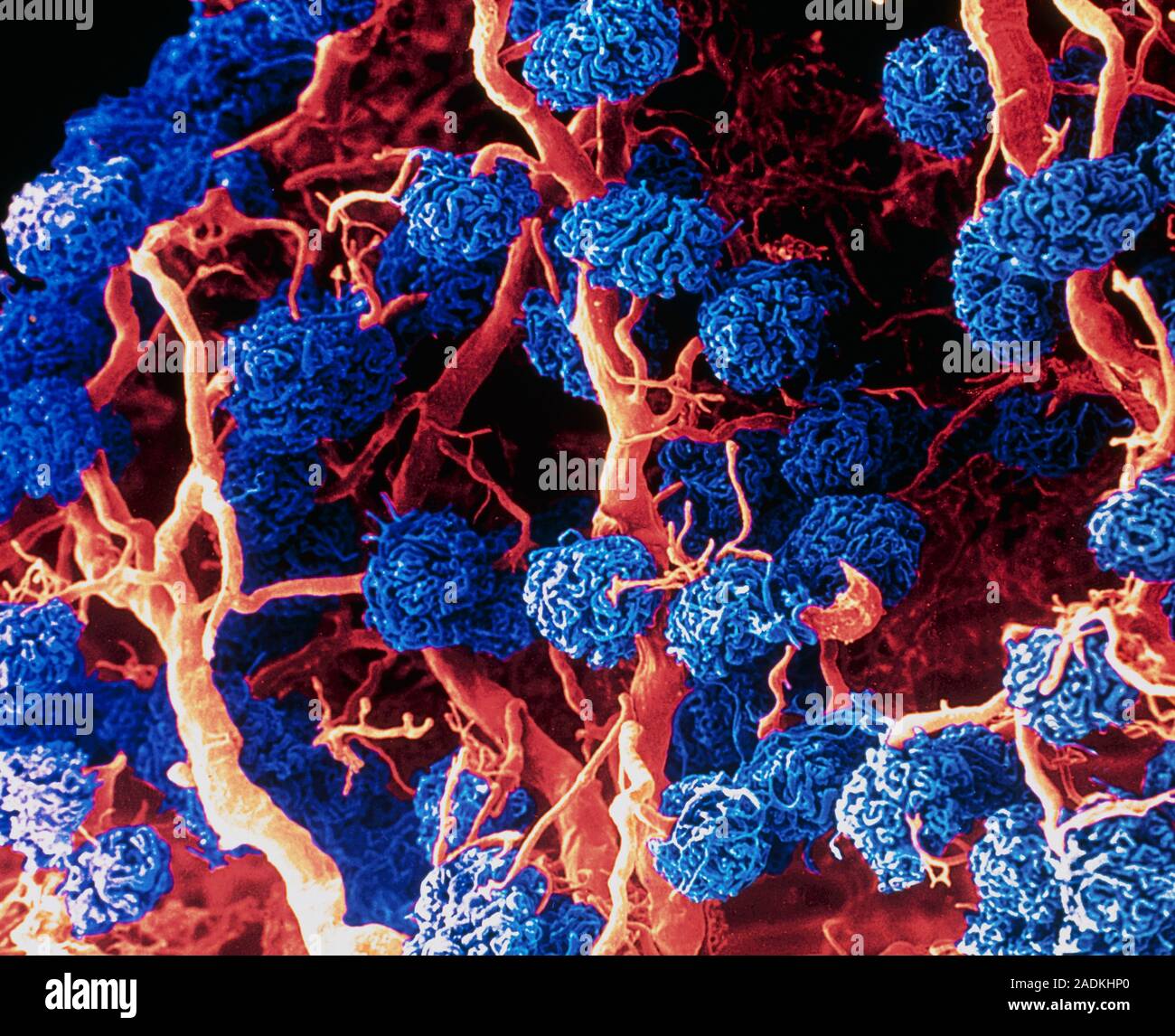 Kidney glomeruli. Coloured scanning electron micrograph (SEM) of ...