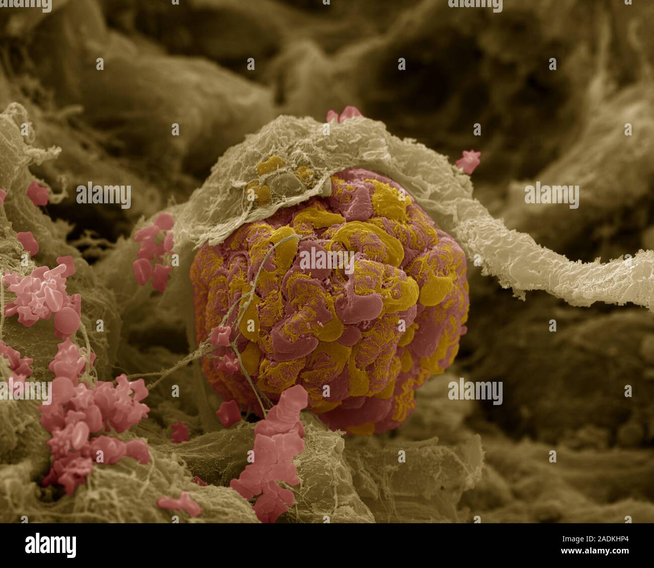 Glomerulus. Coloured scanning electron micrograph (SEM) of a glomerulus ... Glomerulus. Coloured scanning electron micrograph (SEM) of a glomerulus ...