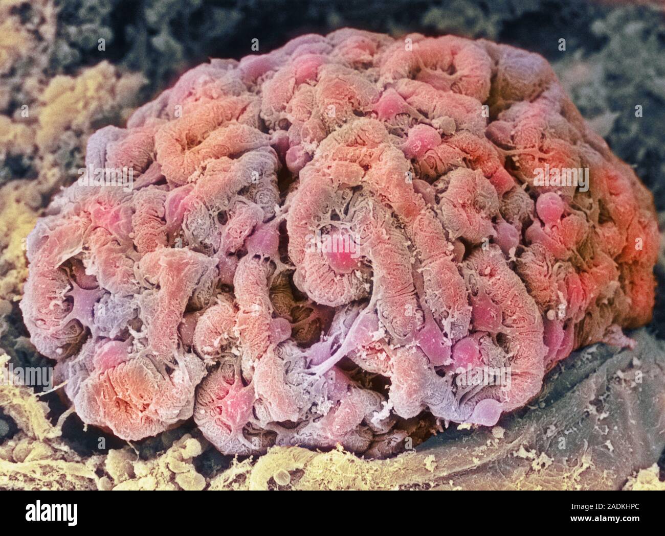 Glomerulus. Coloured scanning electron micrograph (SEM) of a healthy ... Glomerulus. Coloured scanning electron micrograph (SEM) of a healthy ...