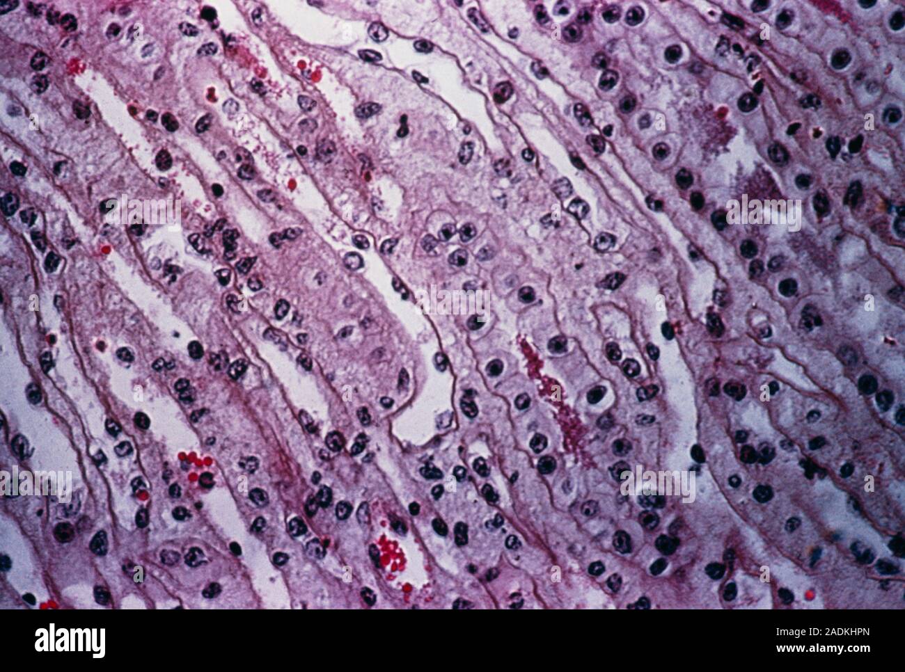 Kidney. Light micrograph of a section through the medulla (central ...