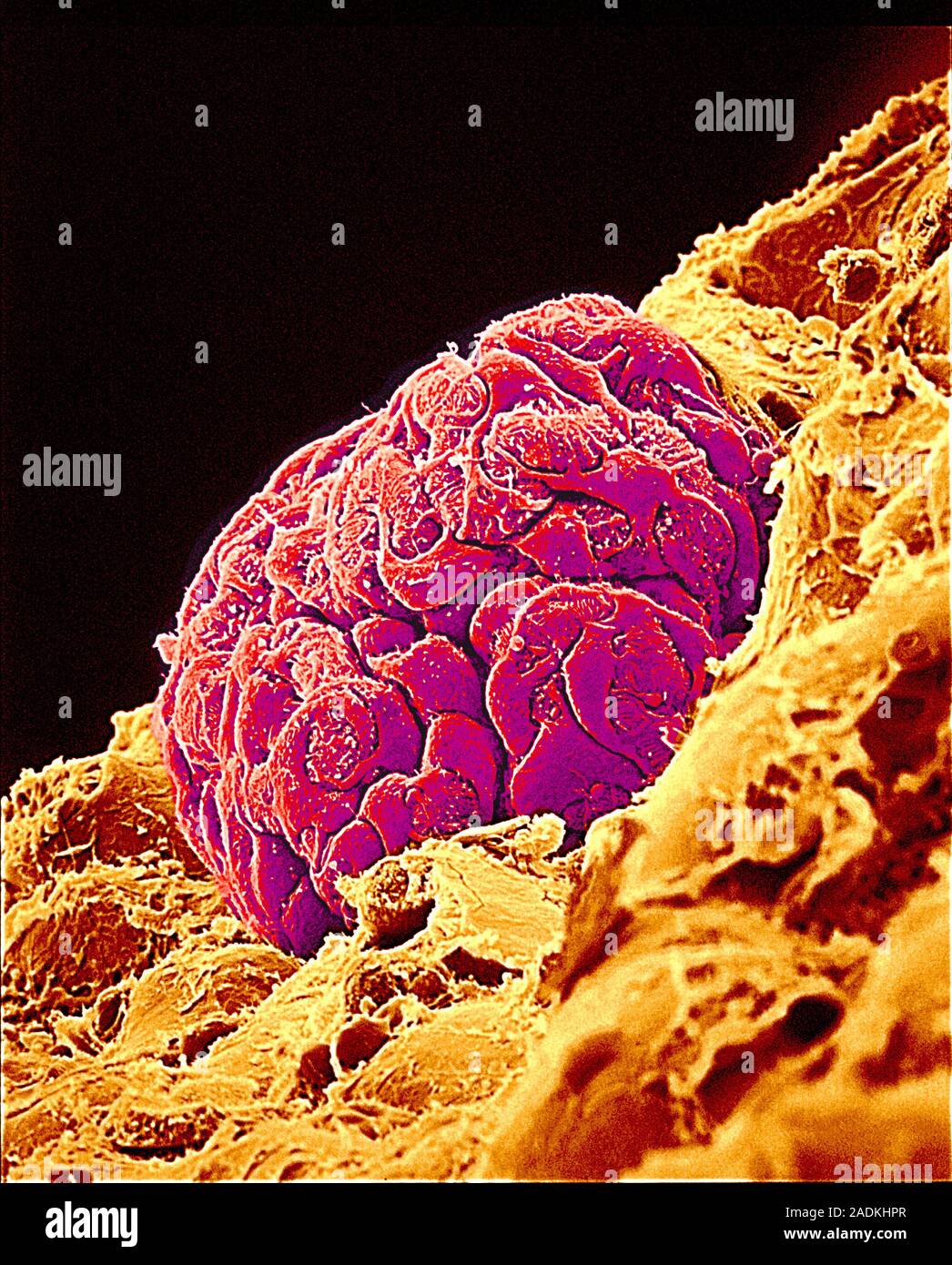 Kidney glomerulus. Coloured scanning electron micrograph (SEM) of a ...