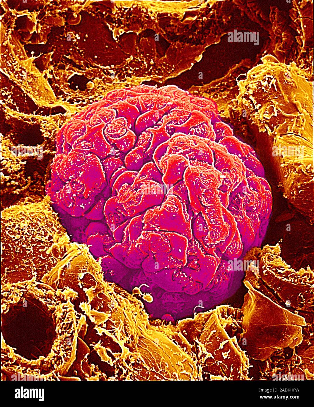 Kidney glomerulus. Coloured scanning electron micrograph (SEM) of a ... Kidney glomerulus. Coloured scanning electron micrograph (SEM) of a ...