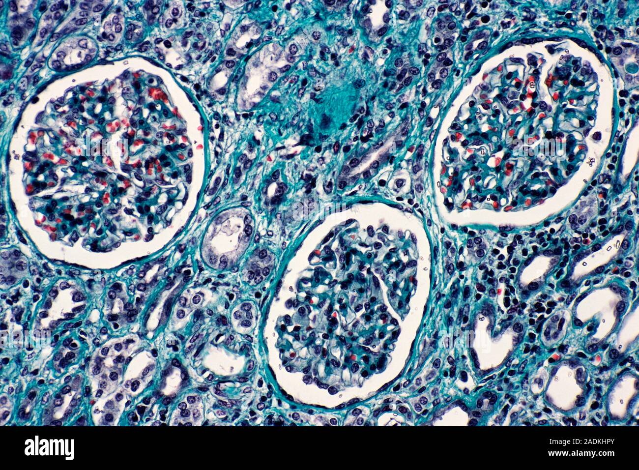 Kidney glomeruli. Light micrograph of a section through a kidney cortex ...