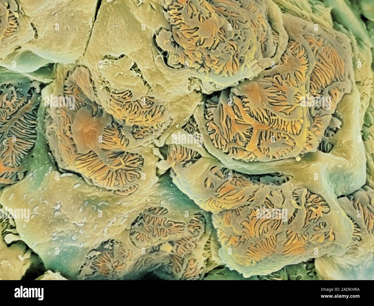 Kidney filtration. Coloured scanning electron micrograph (SEM) of ...