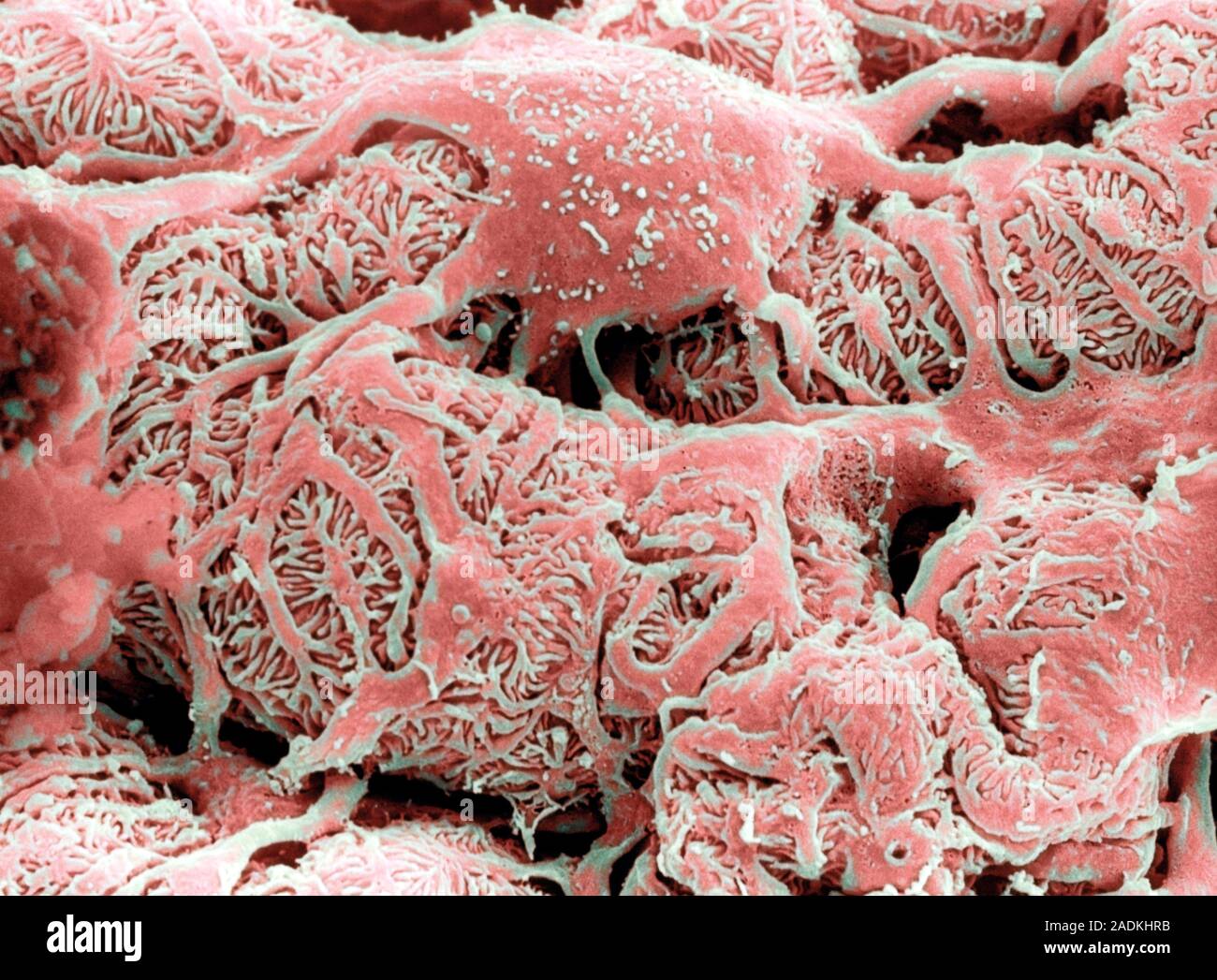 Kidney filtration. Coloured scanning electron micrograph (SEM) of ...