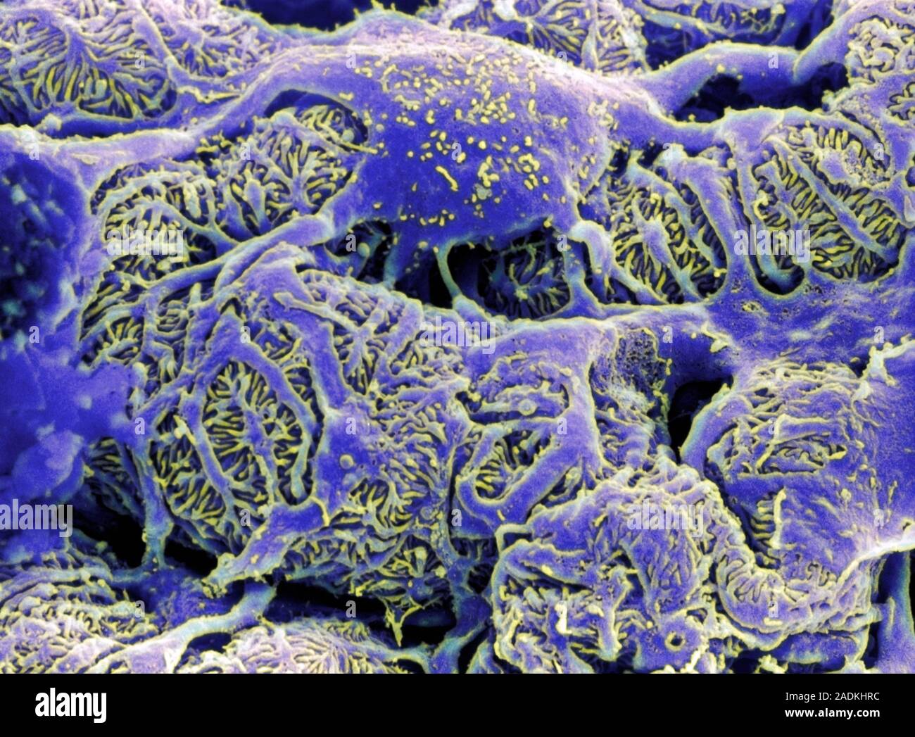 Kidney filtration. Coloured scanning electron micrograph (SEM) of ...