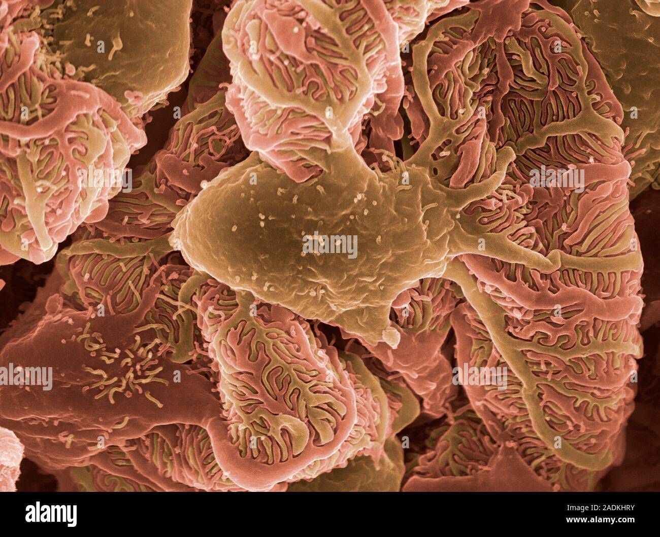 Kidney glomerulus. Coloured scanning electron micrograph (SEM) of ...