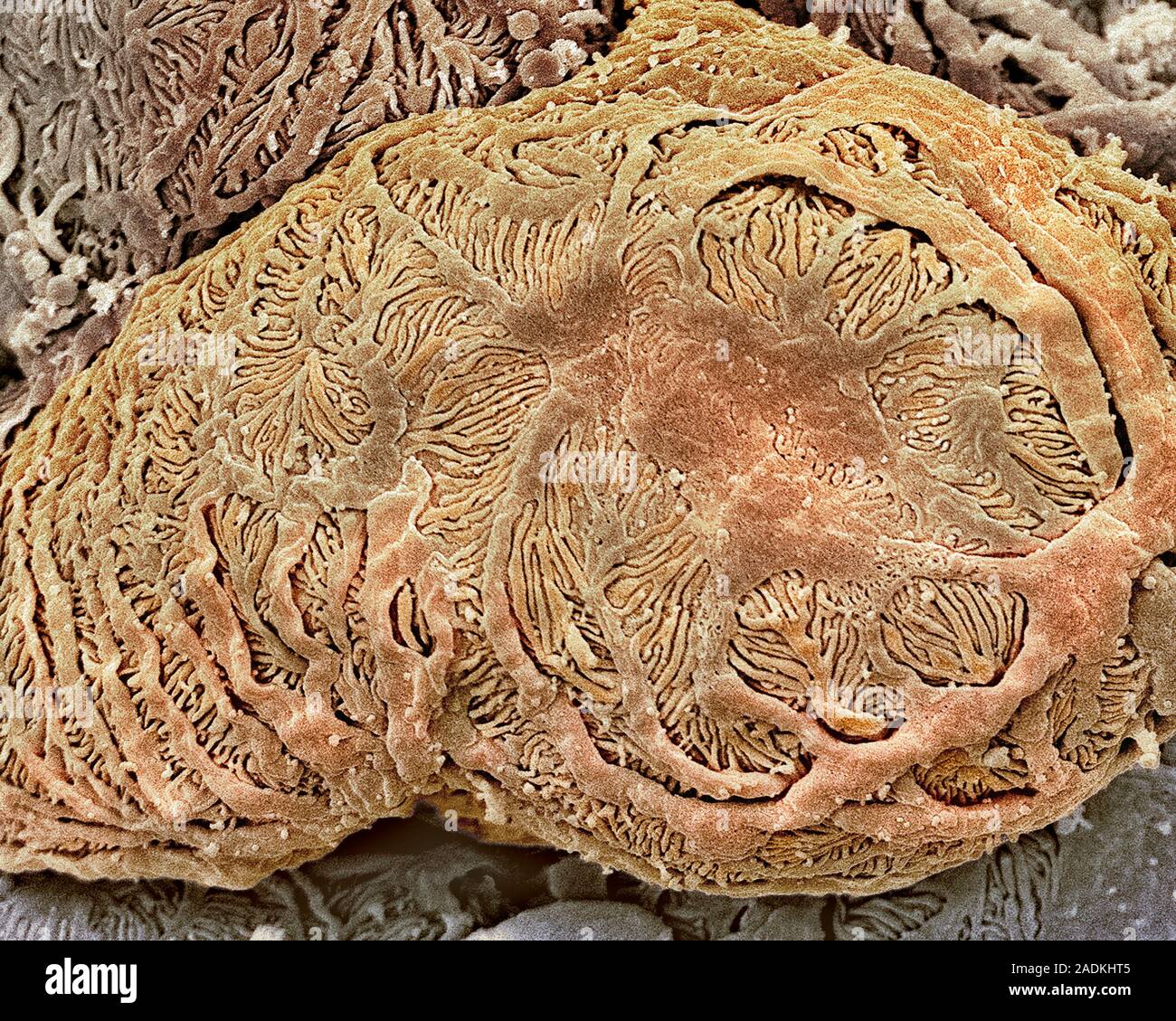 Kidney glomerulus. Coloured scanning electron micrograph (SEM) of ...