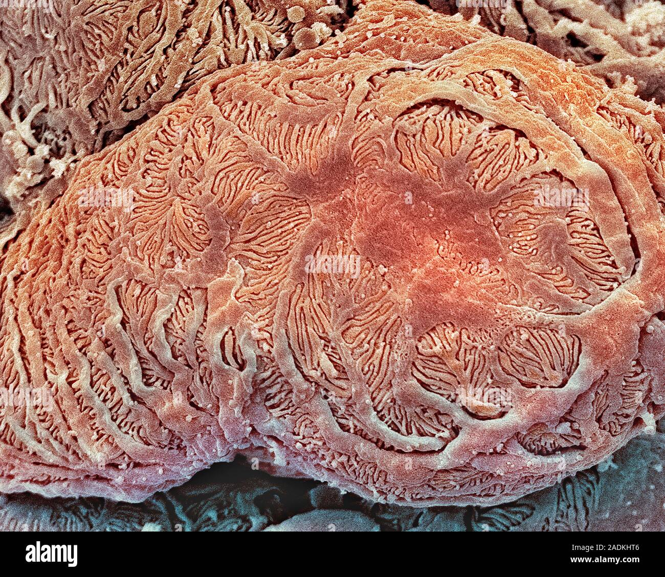 Kidney glomerulus. Coloured scanning electron micrograph (SEM) of ...