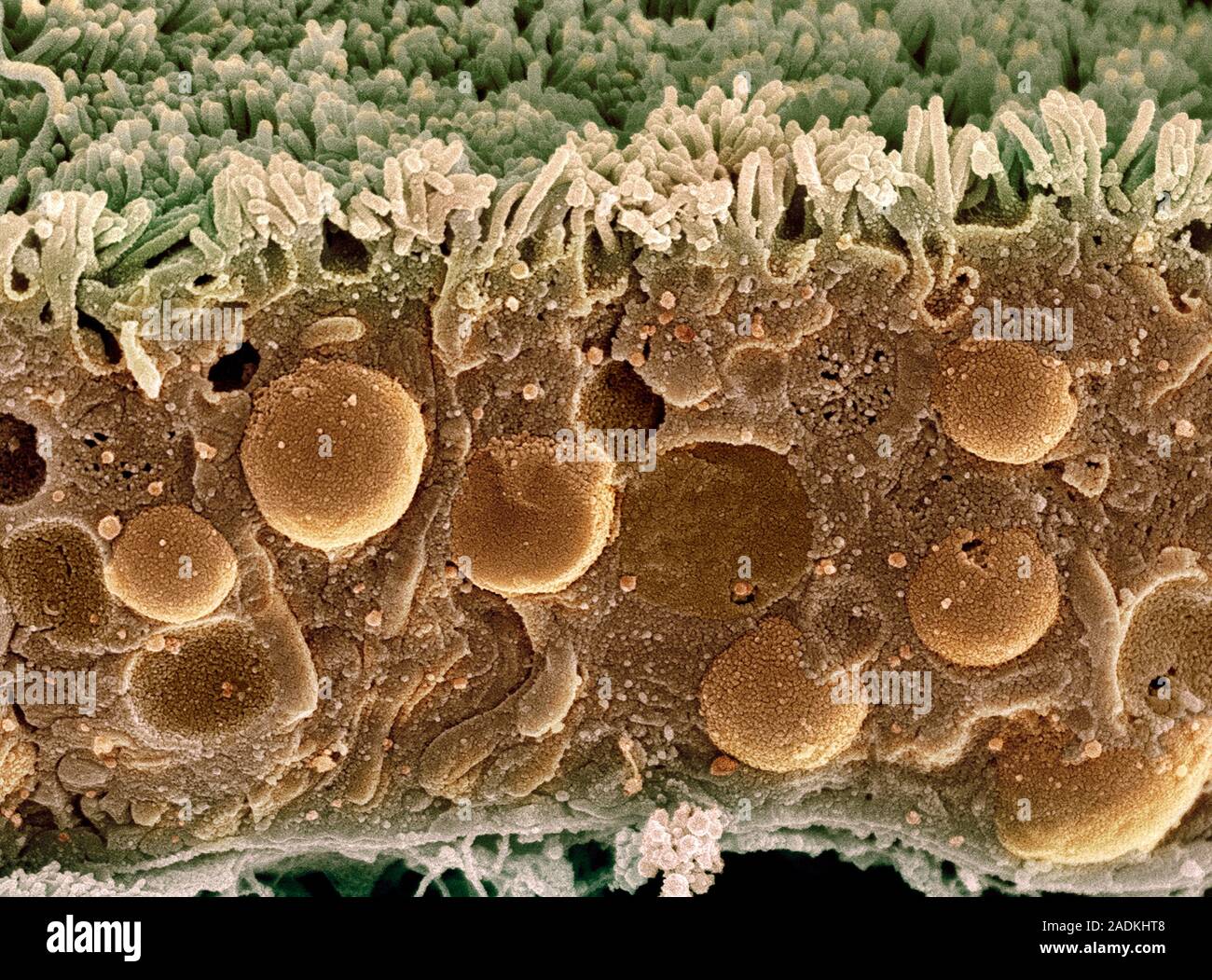 Kidney tubule. Coloured scanning electron micrograph (SEM) of the ...