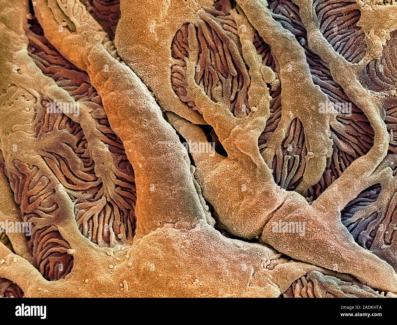 Kidney filtration. Coloured scanning electron micrograph (SEM) of one ...