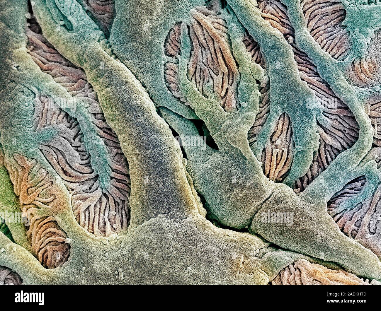 Kidney filtration. Coloured scanning electron micrograph (SEM) of one ...
