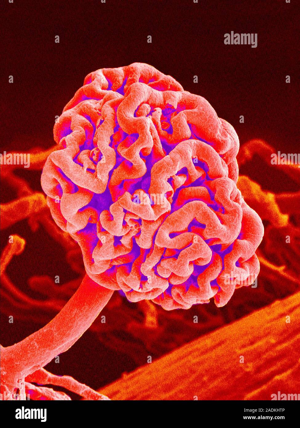 Kidney glomerulus. Coloured scanning electron micrograph (SEM) of a ...