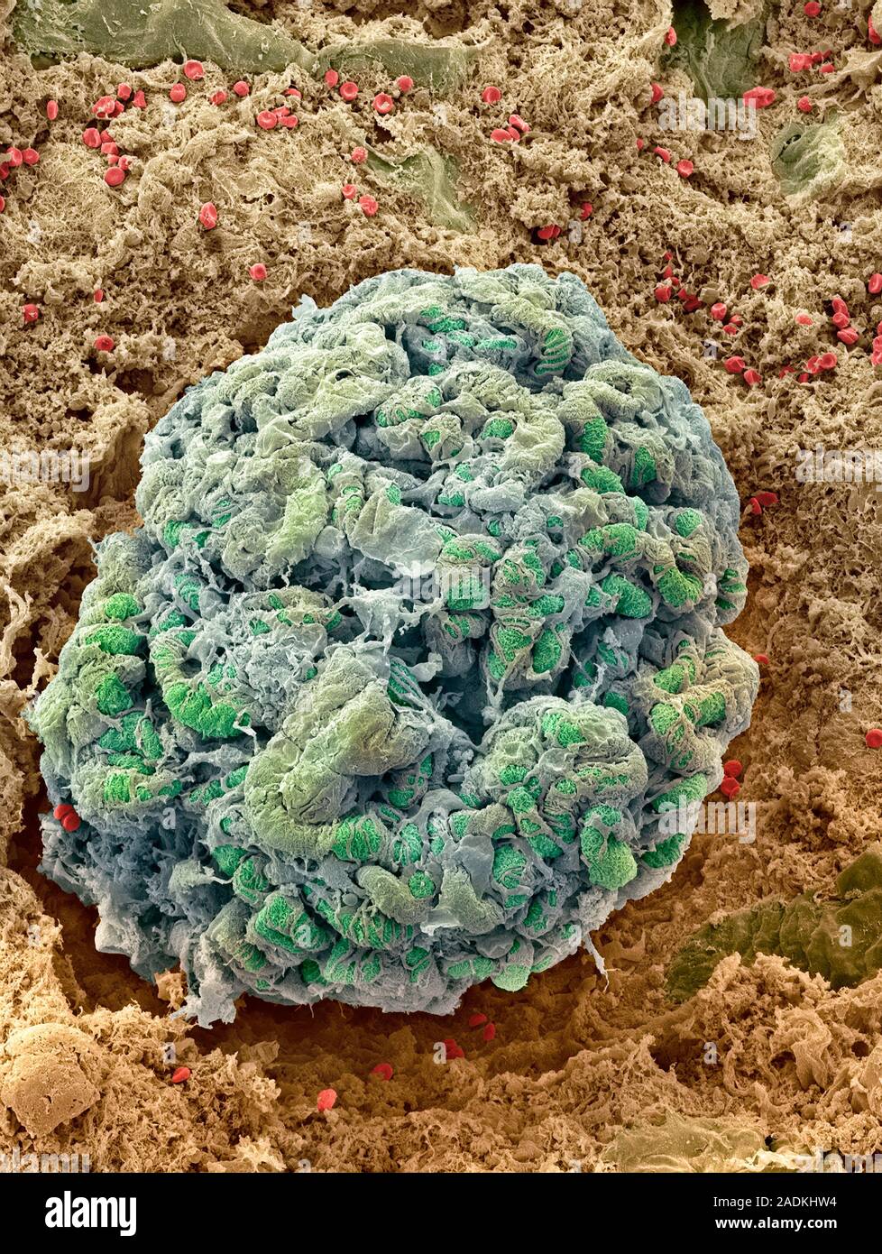 Kidney glomerulus. Coloured scanning electron micrograph (SEM) of ...