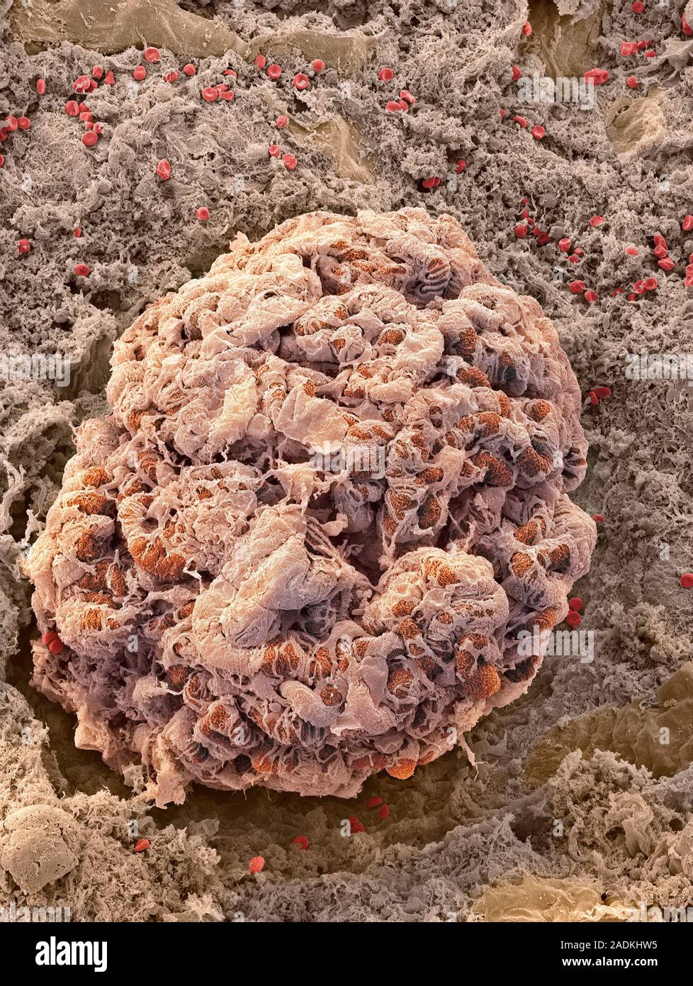 Kidney glomerulus. Coloured scanning electron micrograph (SEM) of ...