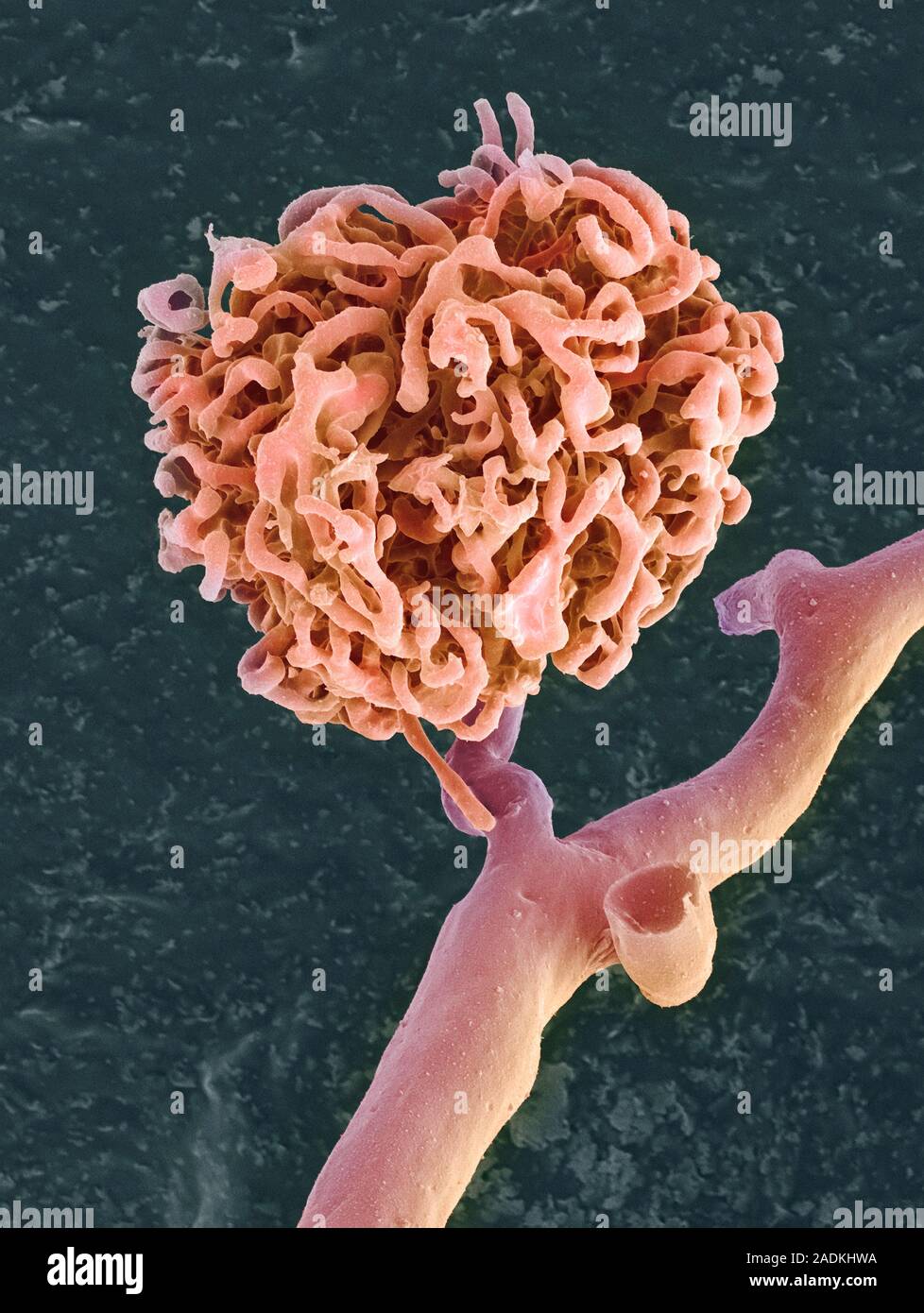 Kidney glomerulus, coloured scanning electron micrograph (SEM). The ...