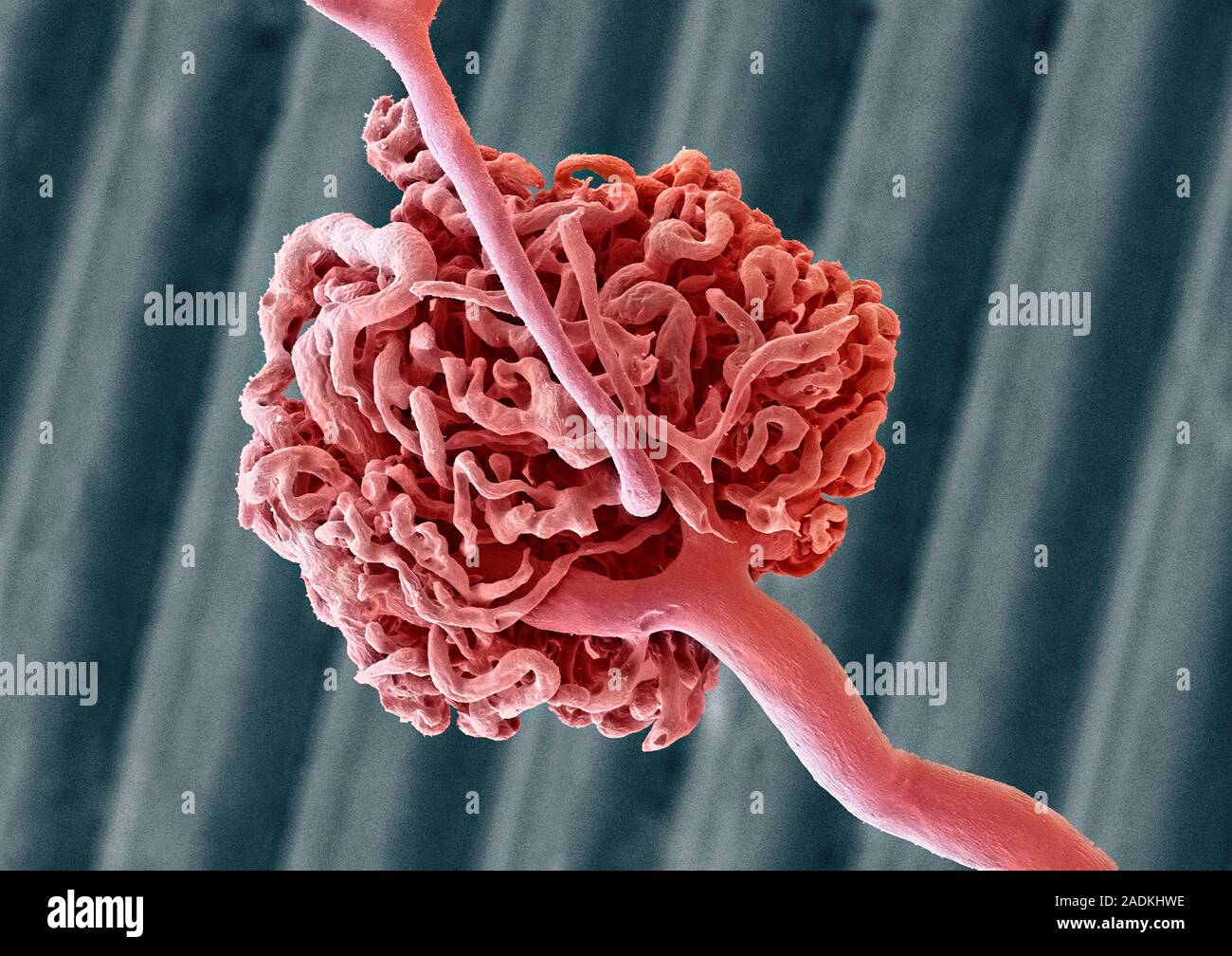 Kidney glomerulus, coloured scanning electron micrograph (SEM). The ...