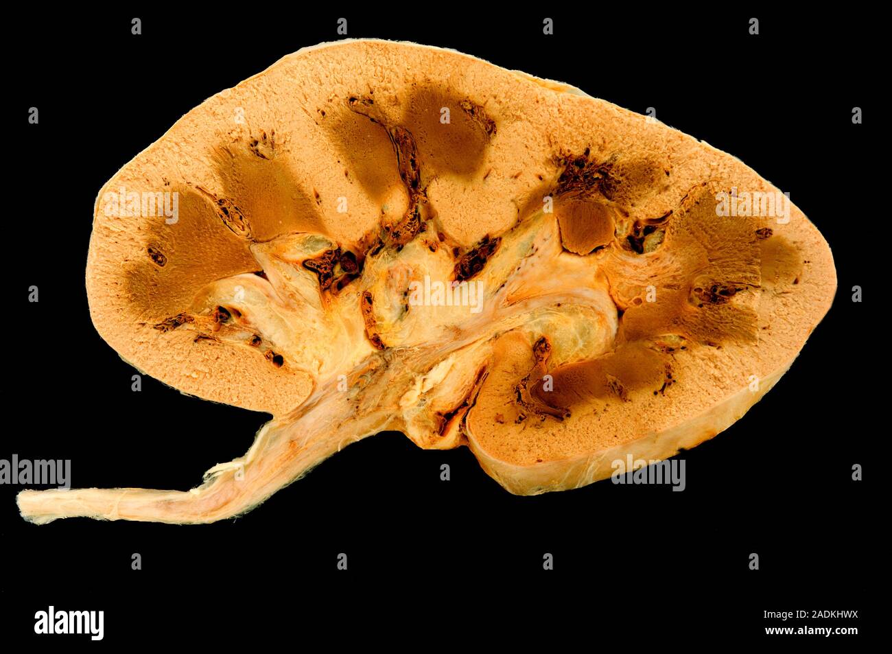 Kidney. Cross-section through a gross specimen of a kidney. The kidneys ...
