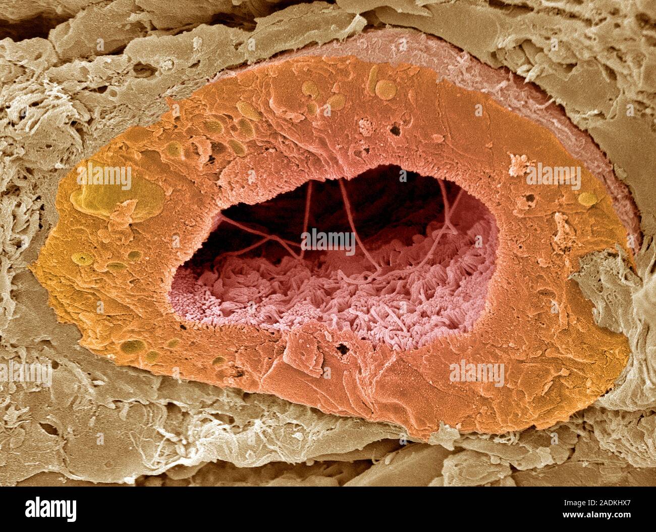 Kidney tubule. Coloured scanning electron micrograph (SEM) of a ...