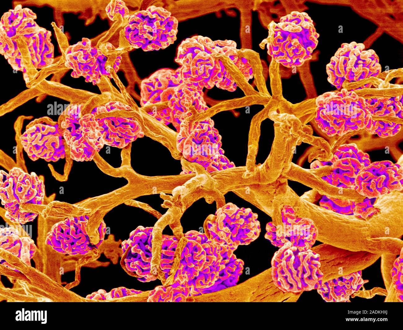 Kidney glomeruli. Coloured scanning electron micrograph (SEM) of a ...