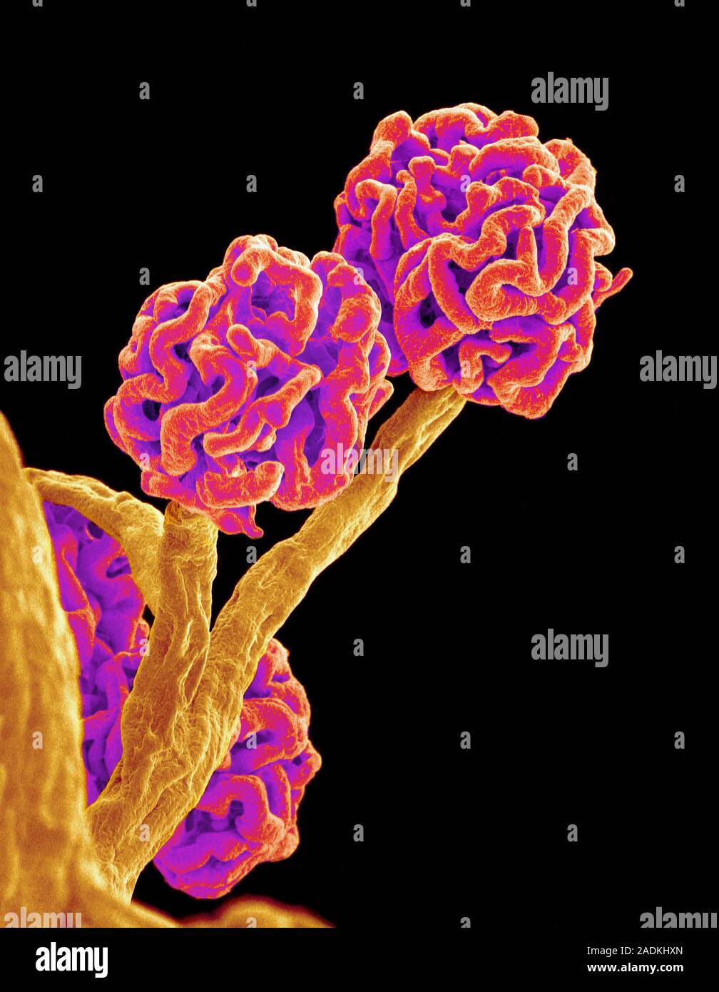 Kidney glomeruli. Coloured scanning electron micrograph (SEM) of a ...