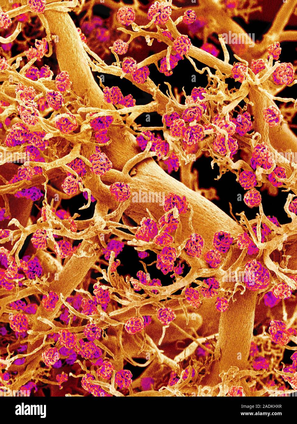 Kidney blood vessels. Coloured scanning electron micrograph (SEM) of a ...