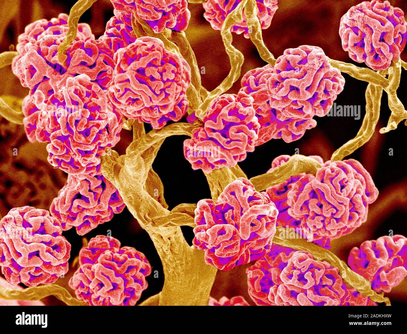 Kidney glomeruli. Coloured scanning electron micrograph (SEM) of a ...