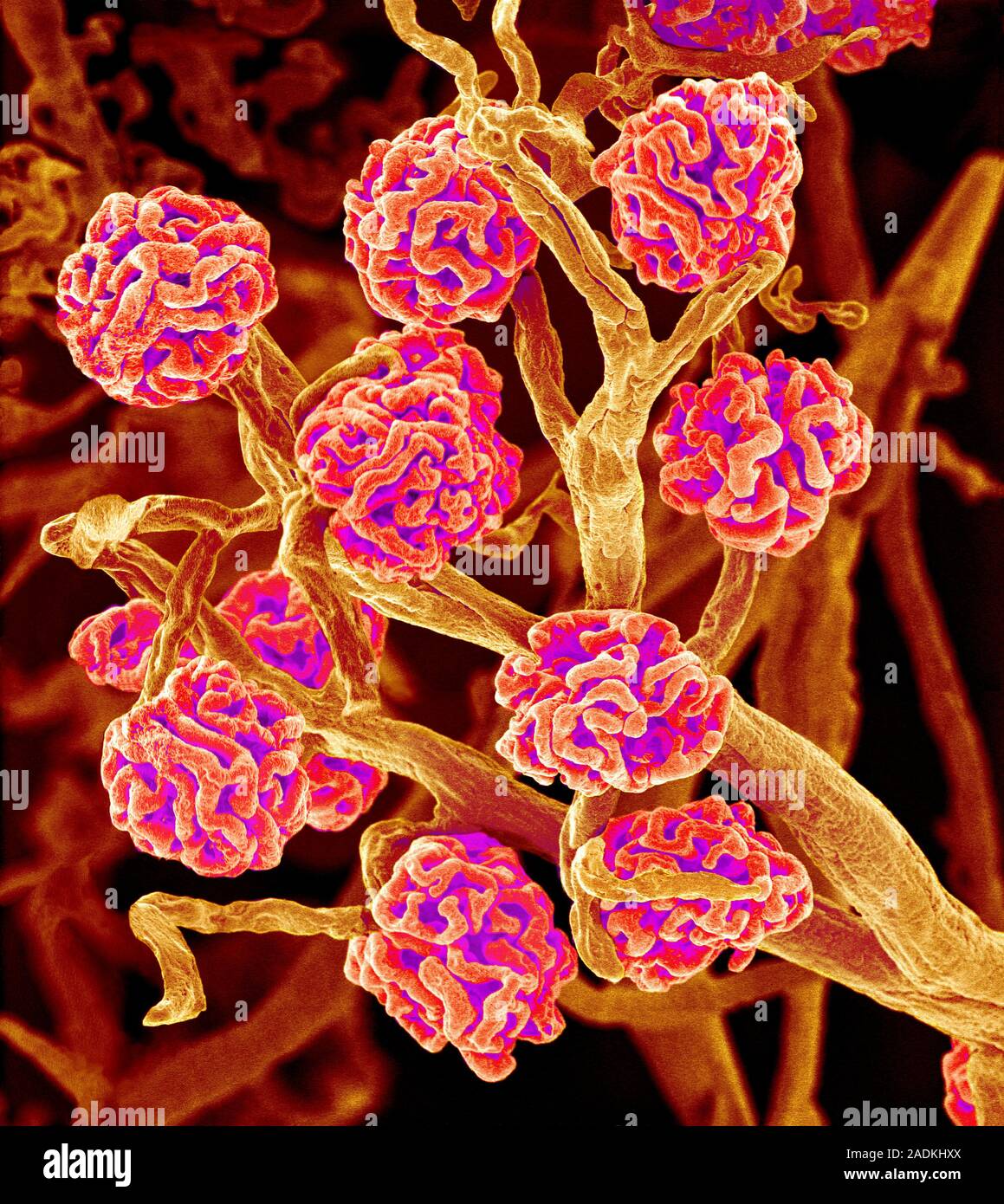 Kidney glomeruli. Coloured scanning electron micrograph (SEM) of a ...