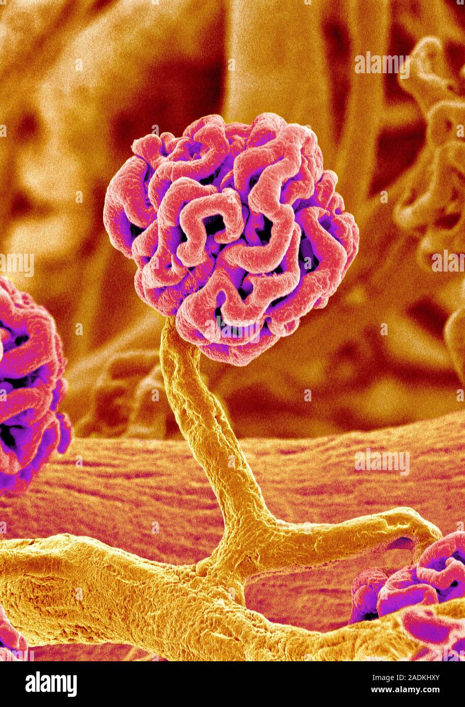 Kidney glomerulus. Coloured scanning electron micrograph (SEM) of a ...