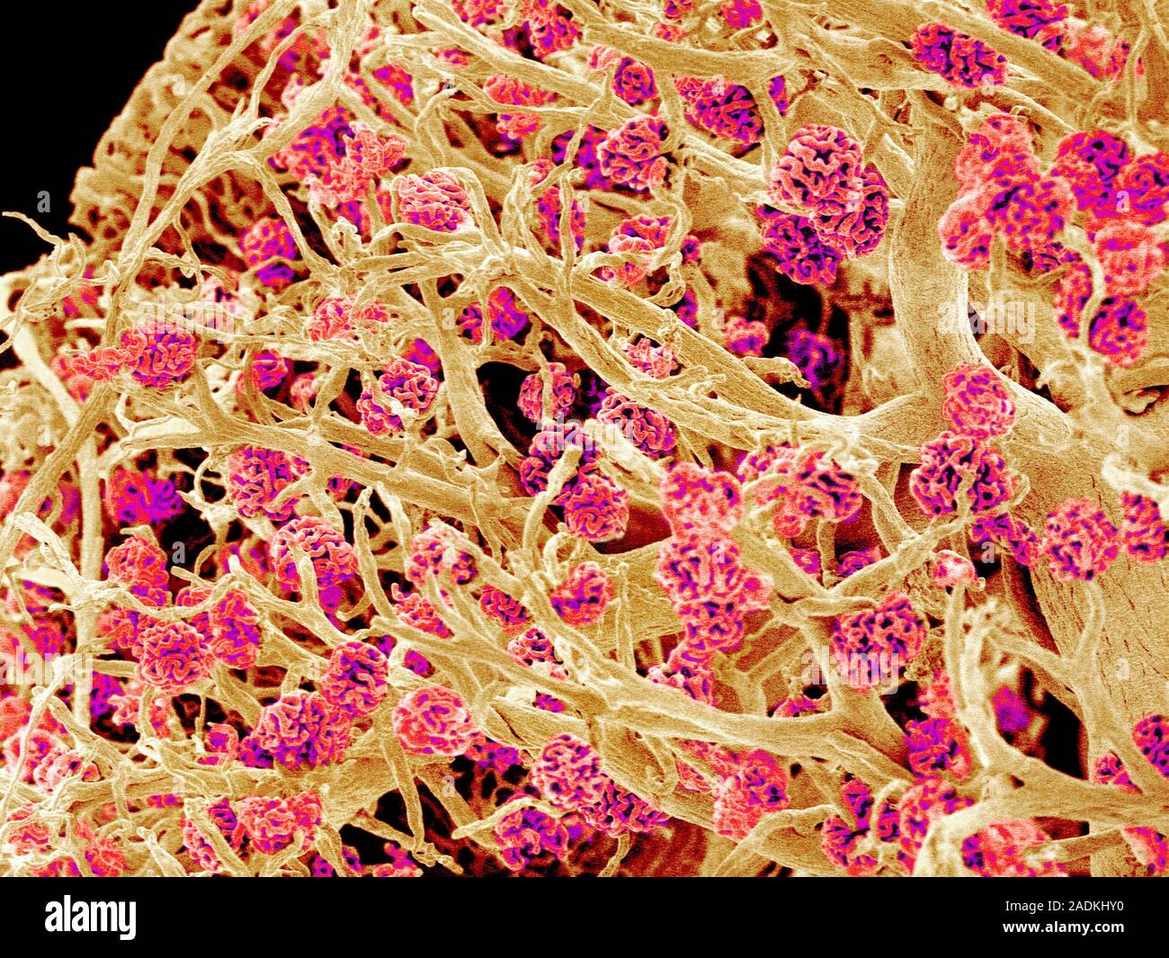 Kidney blood vessels. Coloured scanning electron micrograph (SEM) of a ...