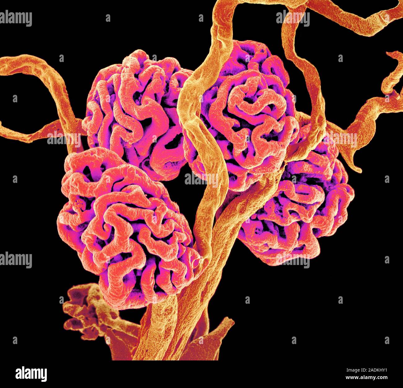 Kidney glomeruli. Coloured scanning electron micrograph (SEM) of a ...
