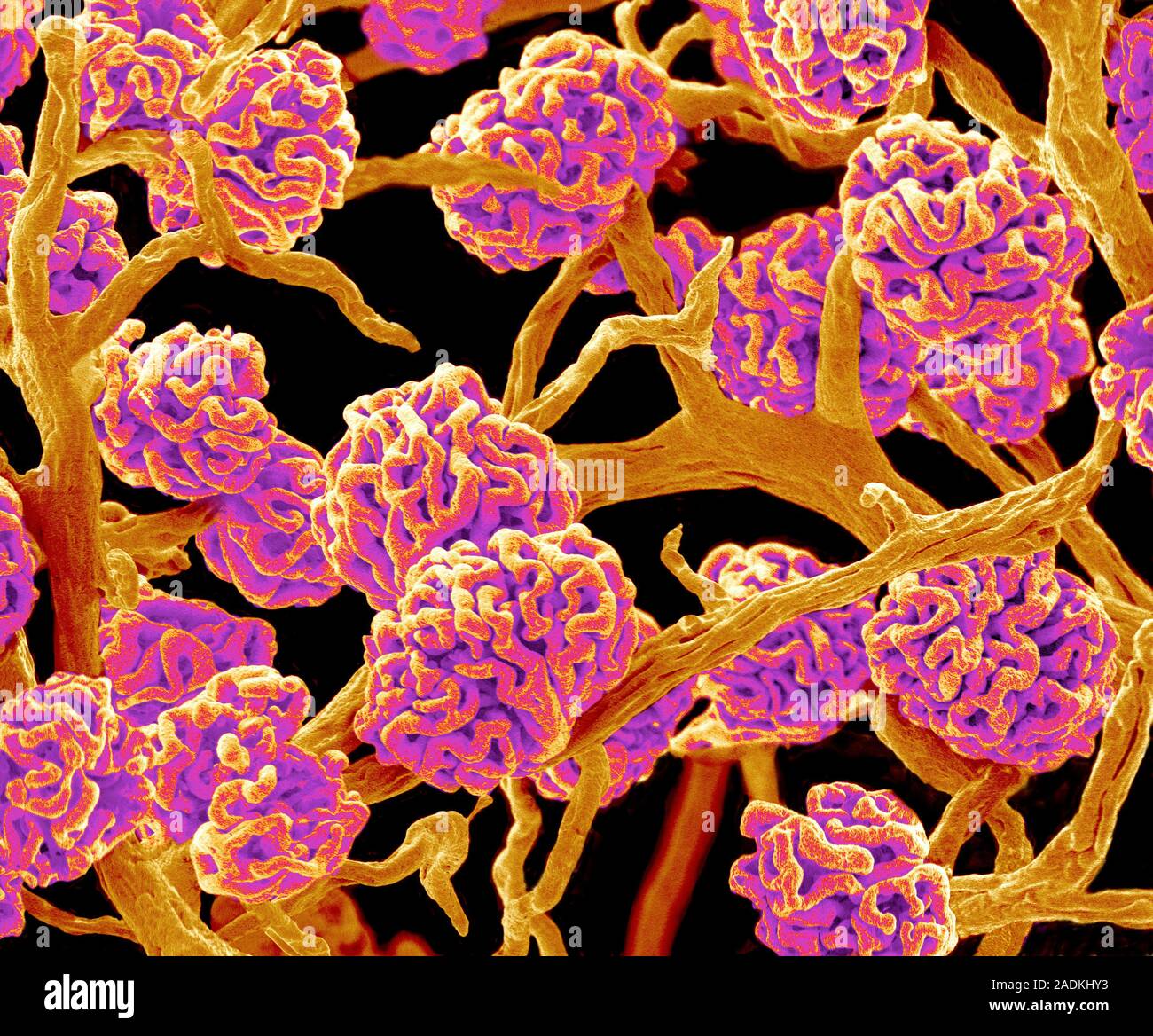 Kidney glomeruli. Coloured scanning electron micrograph (SEM) of a ...