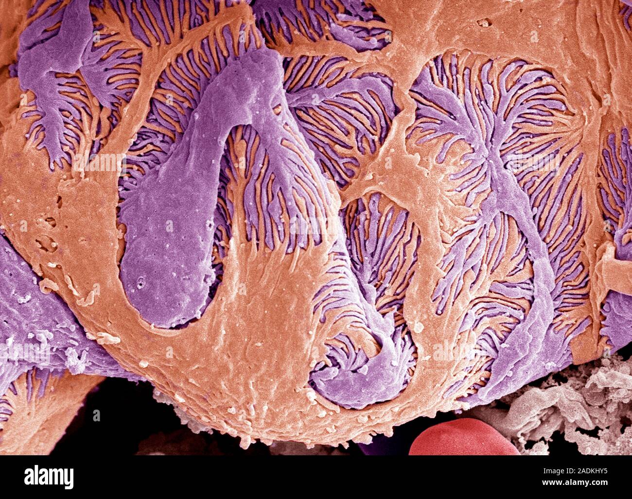 Kidney glomerulus. Coloured scanning electron micrograph (SEM) of ...