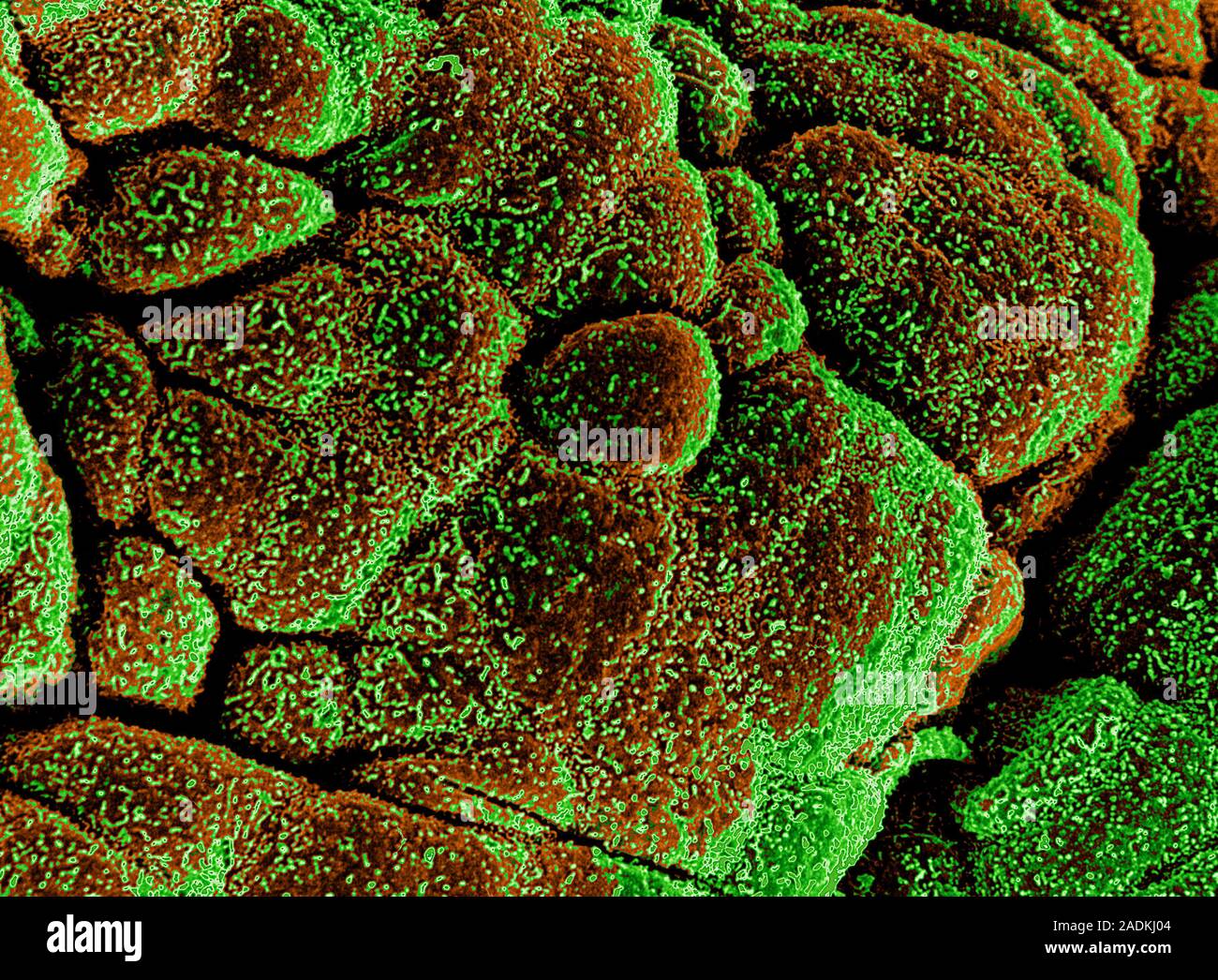 Bladder epithelium. Coloured scanning electron micrograph (SEM) of ...