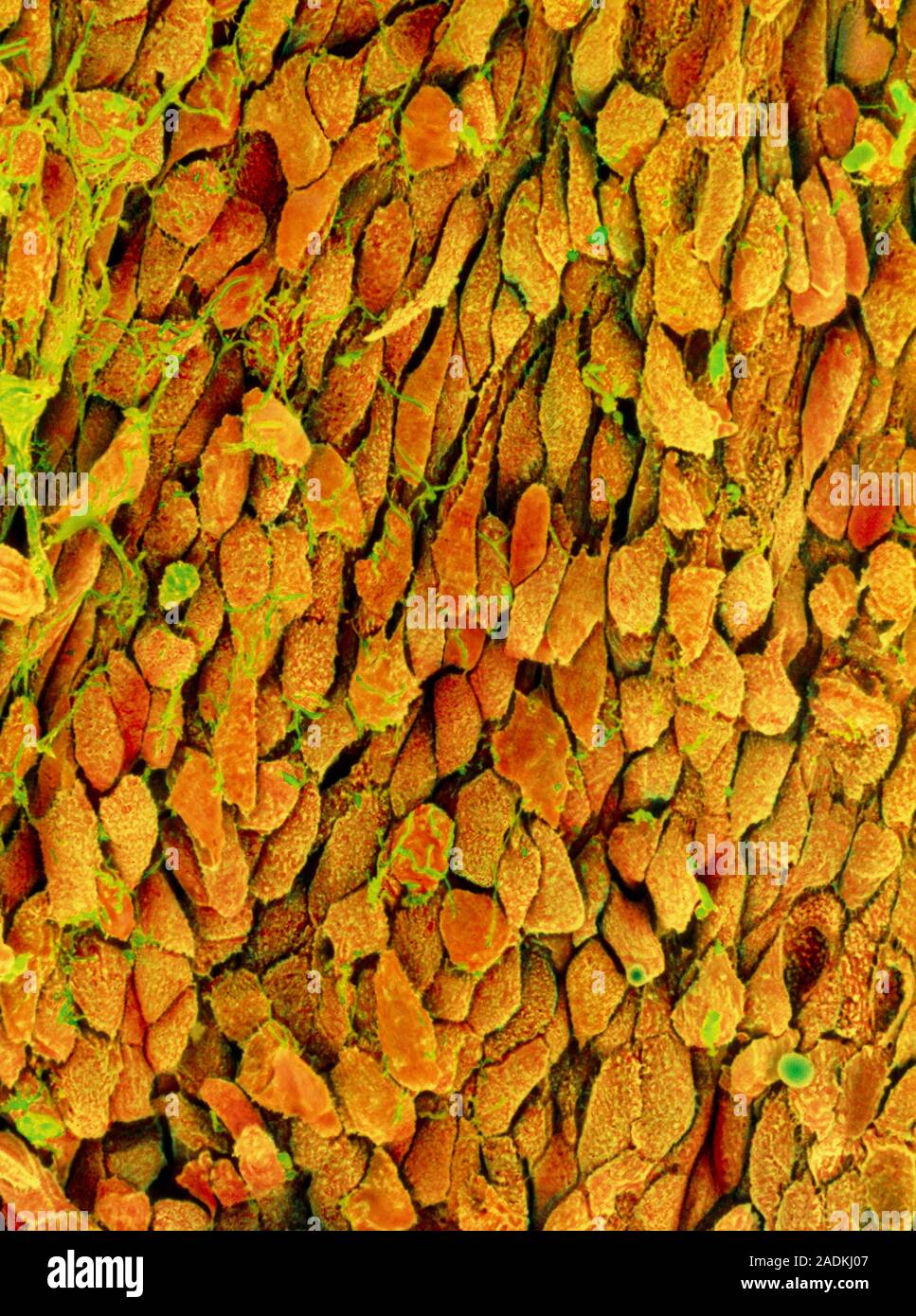 Bladder epithelium. Coloured scanning electron micrograph (SEM) of flattened epithelial cells ...