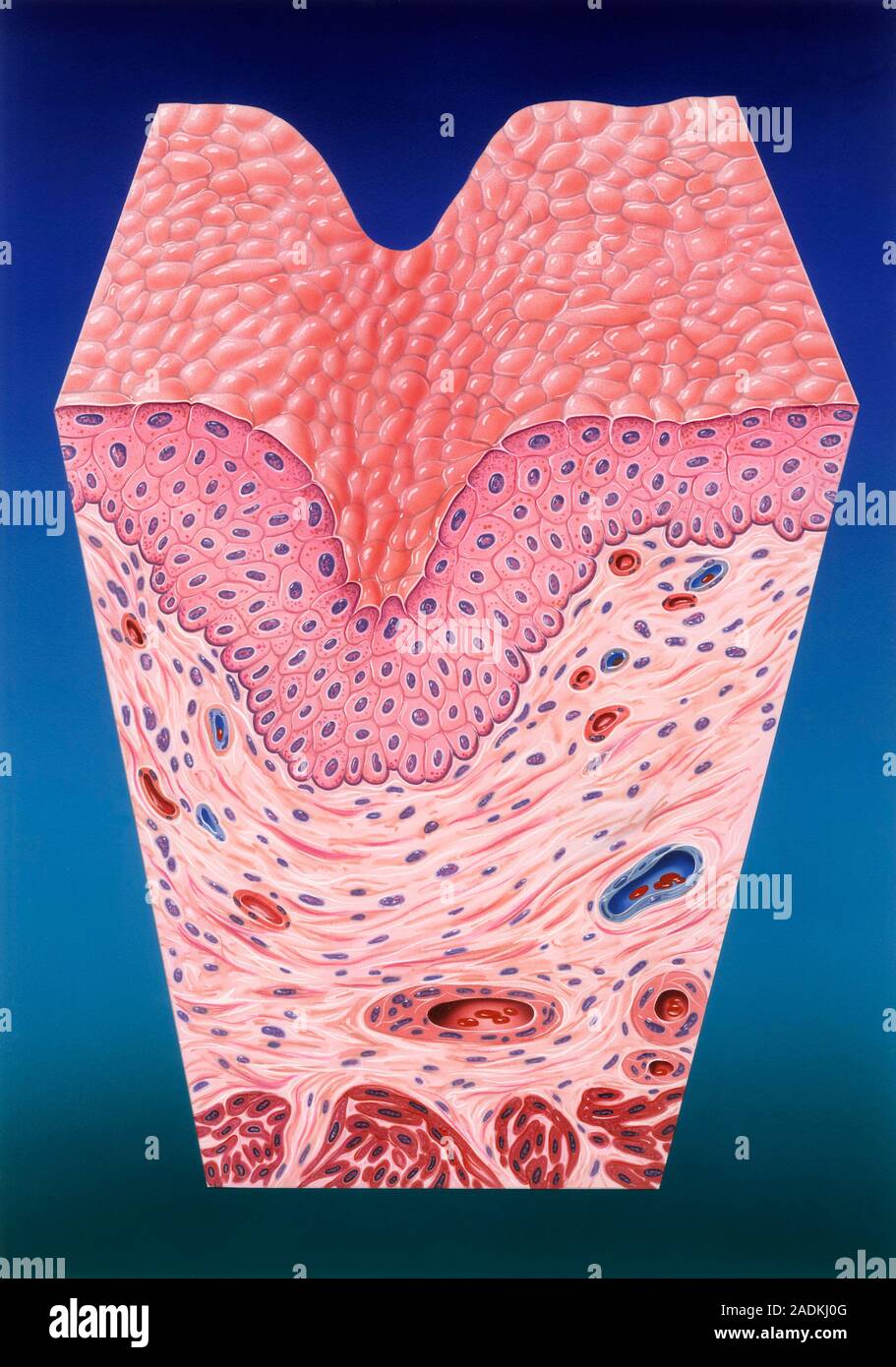 Urinary bladder wall. Artwork of a section through the wall of a ...