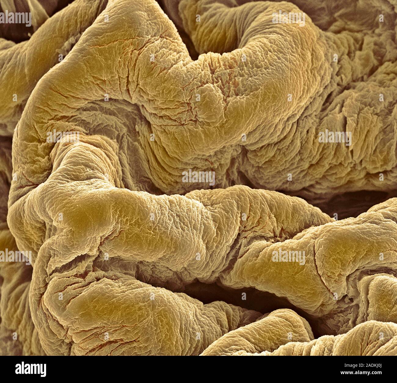 Bladder lining. Coloured scanning electron micrograph (SEM) of the ...