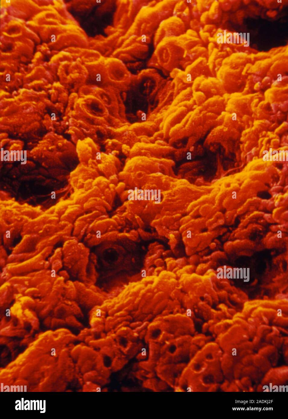 False-colour scanning electron micrograph (SEM) of a section of the ...