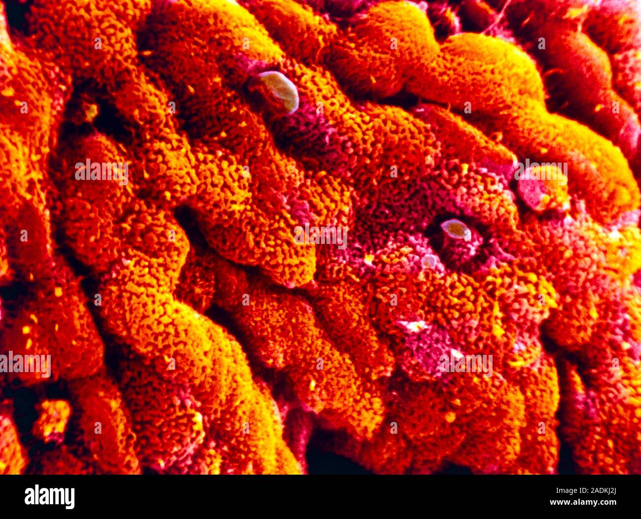 False-colour scanning electron micrograph (SEM) of the mucosal ...