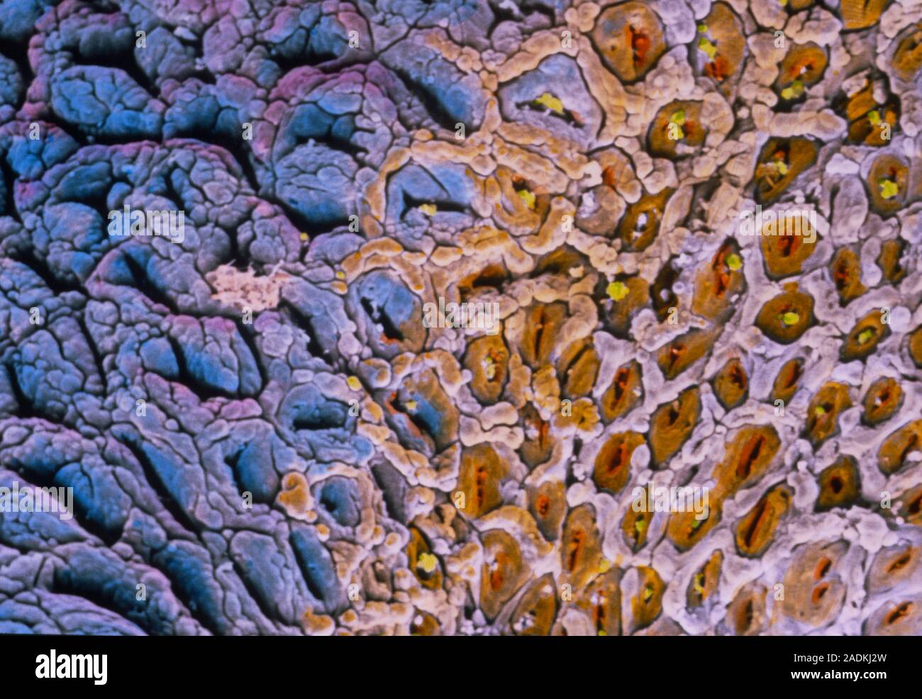 Junction of small & large intestine: false-colour scanning electron ...