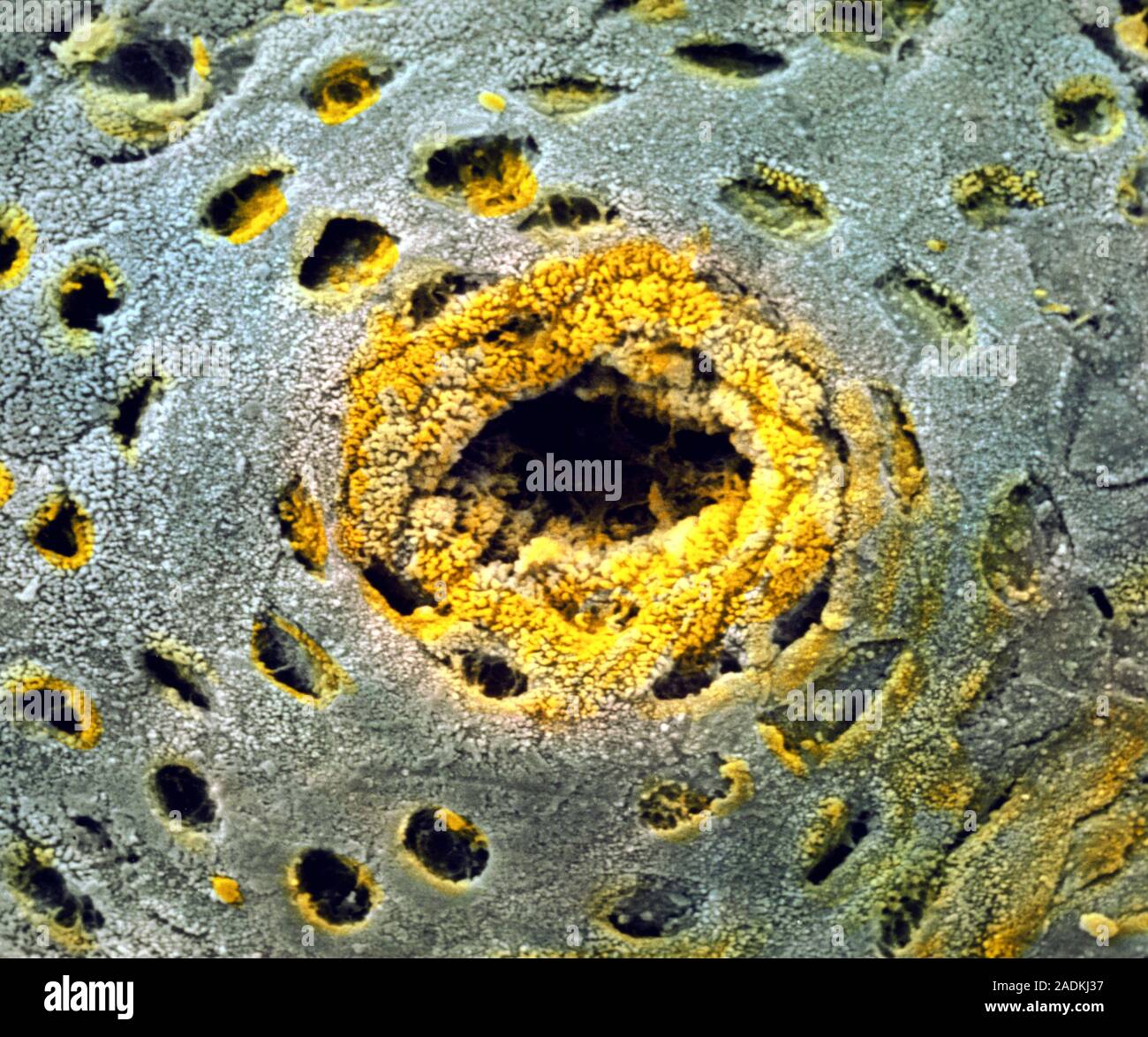 Colon surface. Coloured Scanning Electron Micrograph (SEM) of the ...