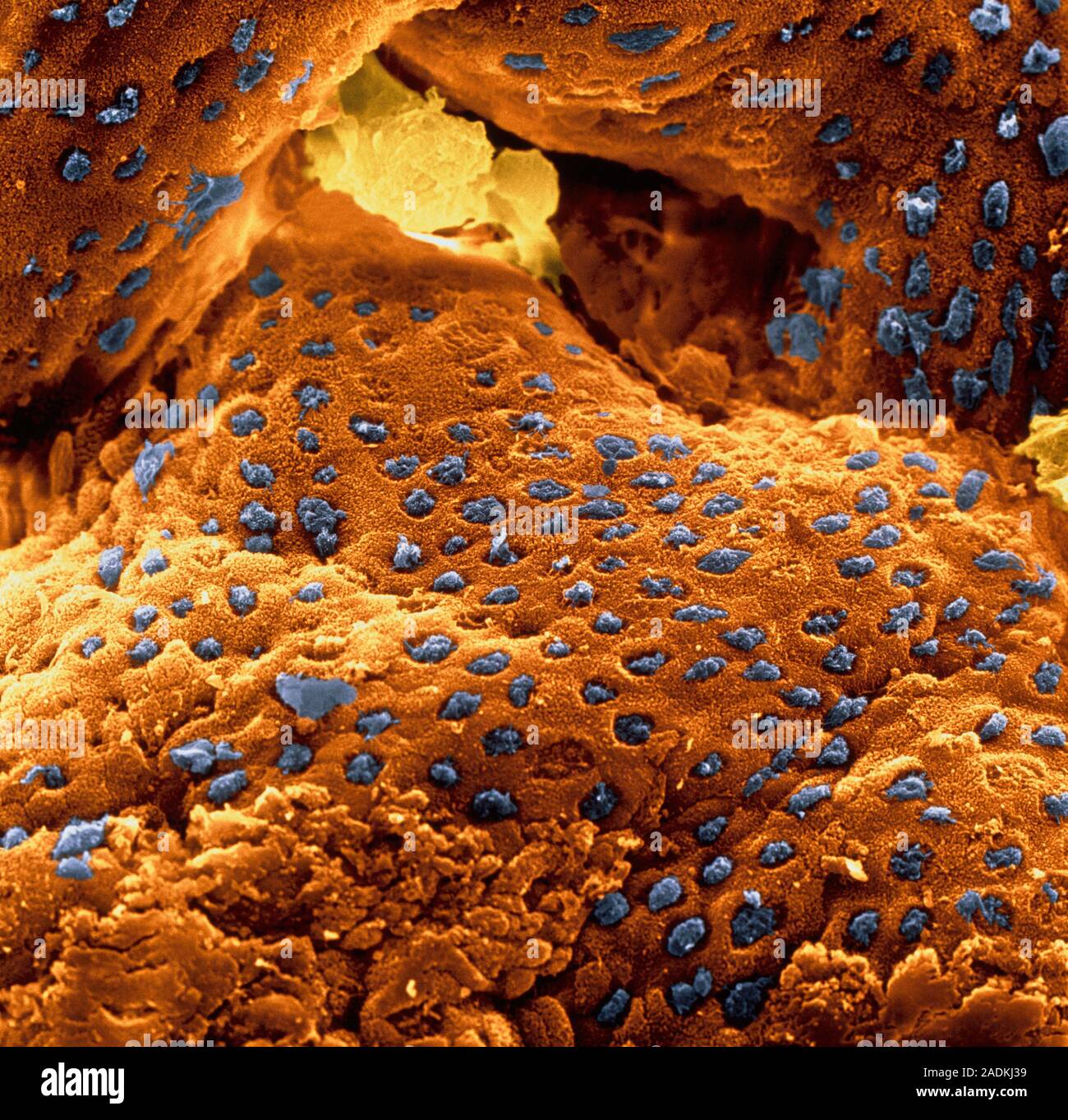 Colon surface. Coloured Scanning Electron Micro- graph (SEM) of the ...