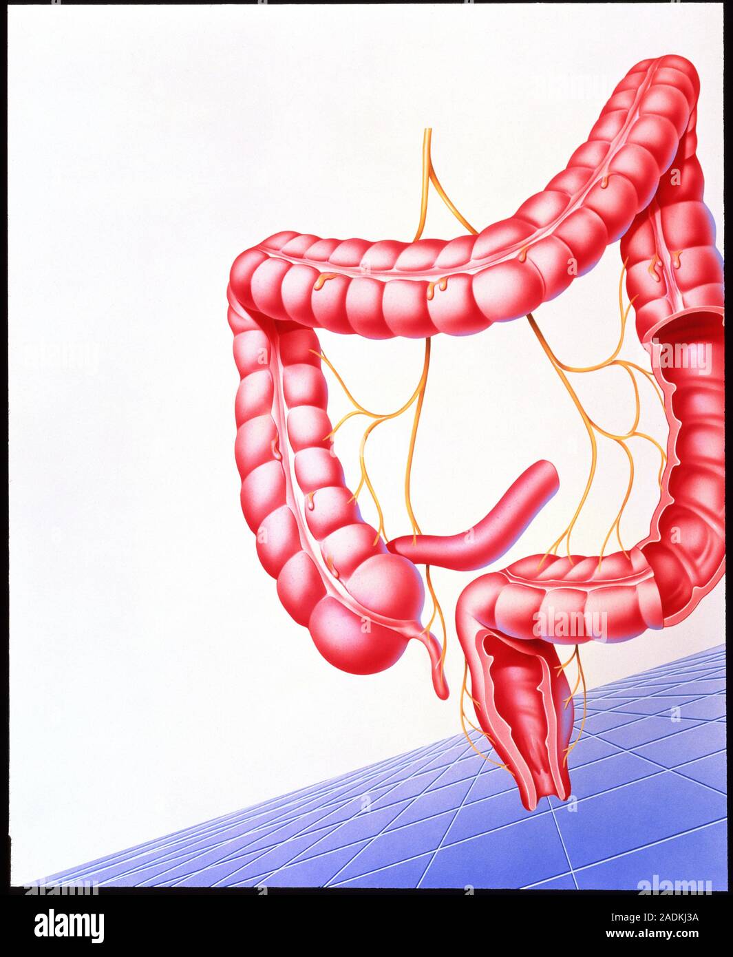 Colon. Artwork showing the human colon (large intestine). The yellow ...