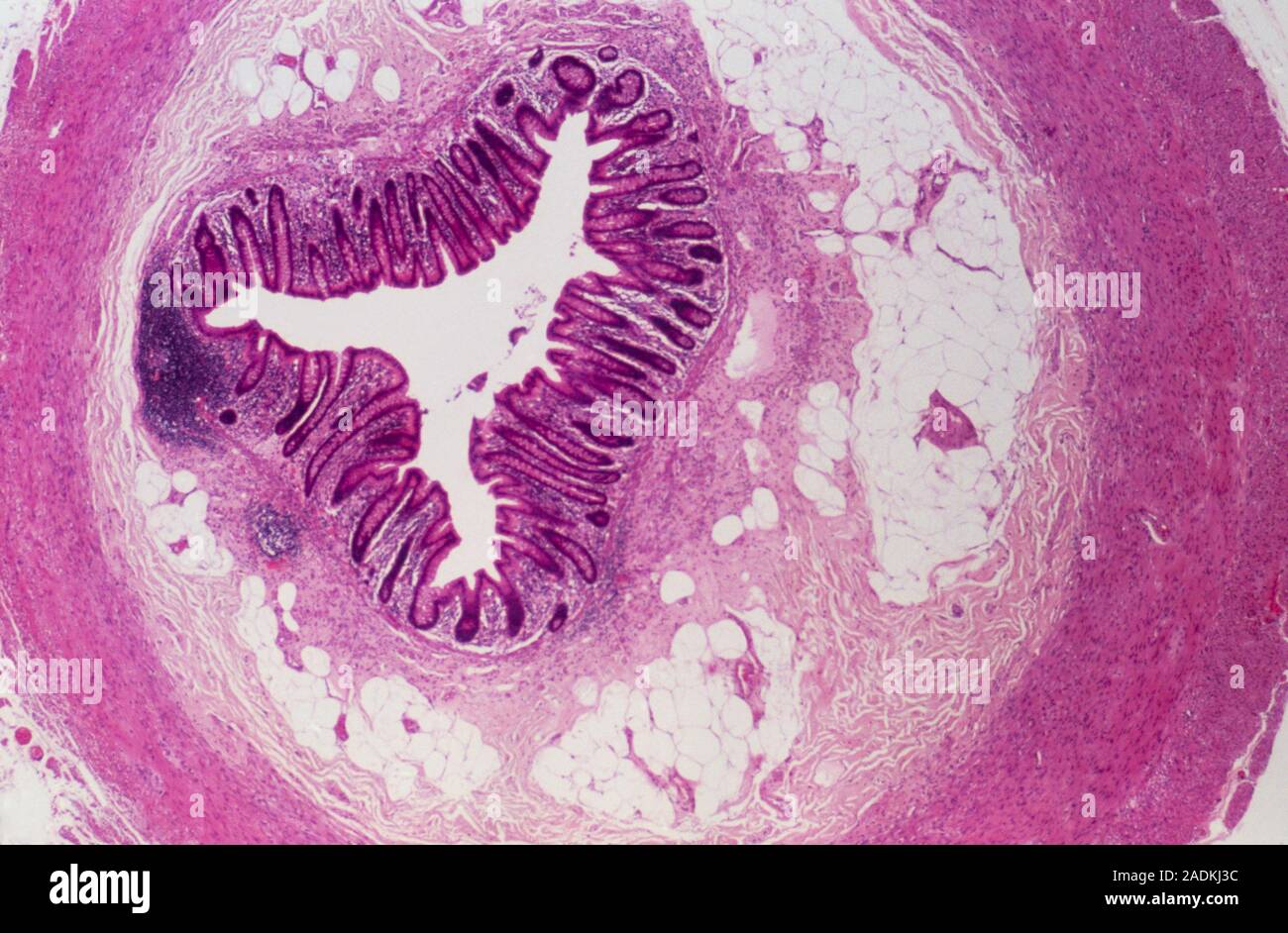 Appendix. Light micrograph of a section through the human appendix. The ...