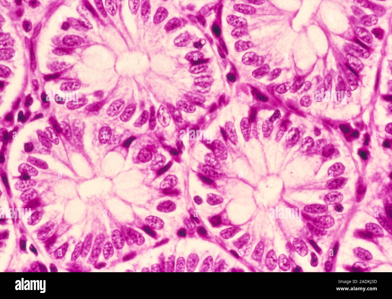Colon glands. Light micrograph of a cross section through mucosal ...